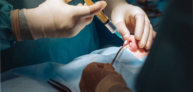 Adenoamigdalectomia – Cirurgia de remoção das amígdalas e da adenóide ...